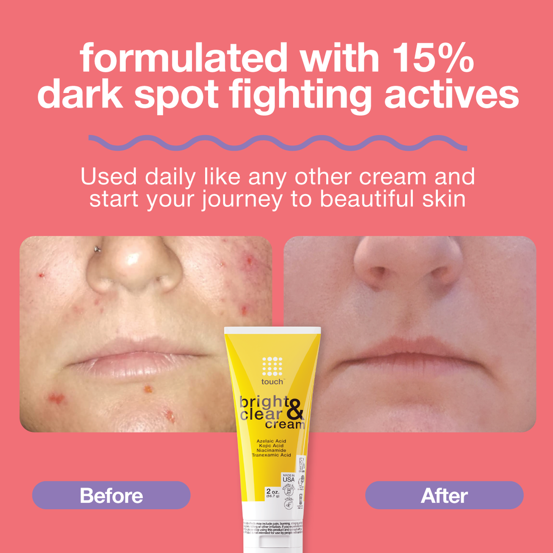Face Brightening Cream for Even tone & Glowing Skin - Touch Skin Care